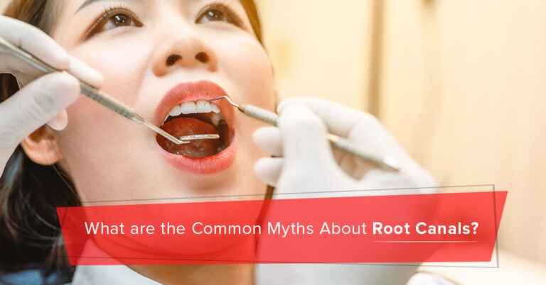 Do Root Canals Really Cause Illness? Get the Facts